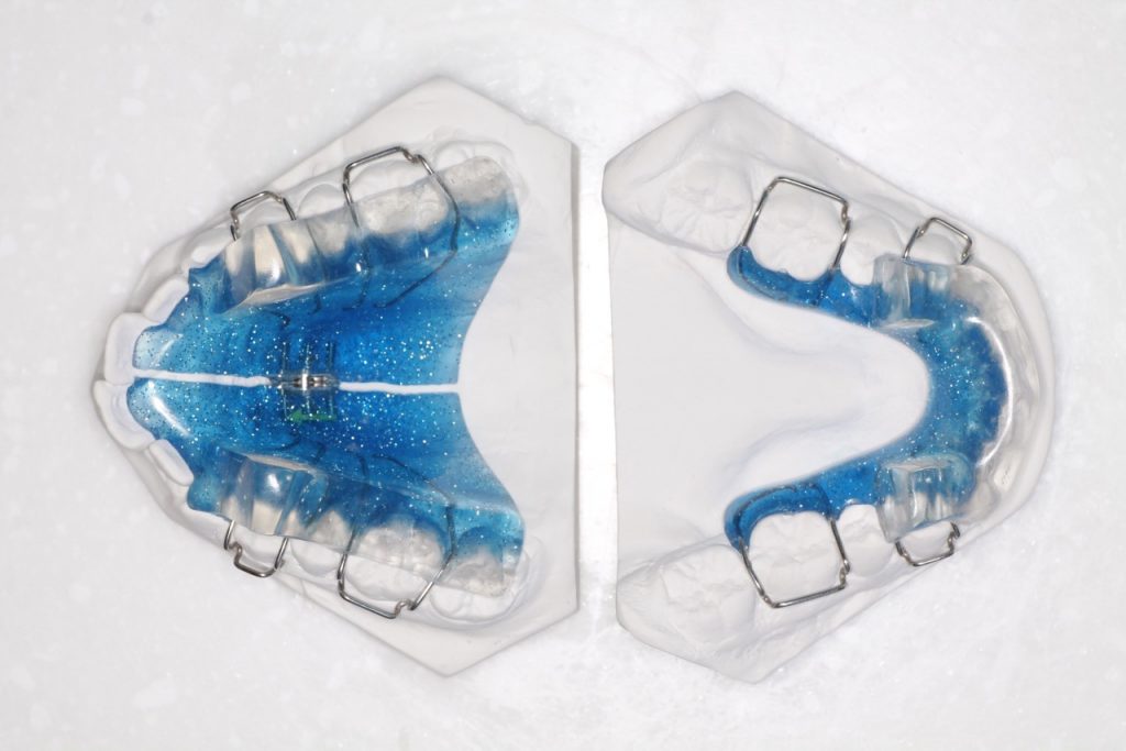 Types Of Treatment | Hamilton Orthodontics