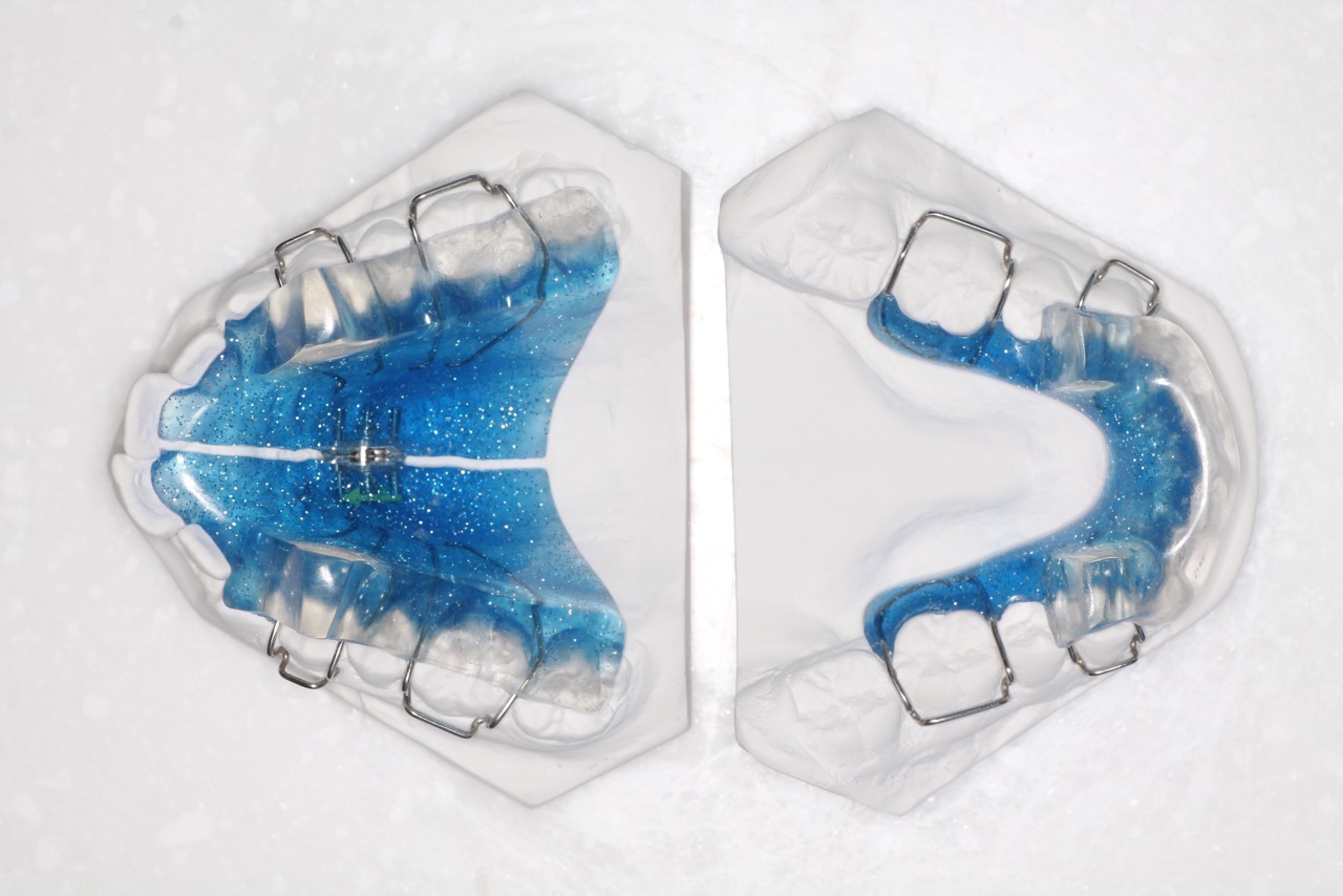 Types Of Treatment | Hamilton Orthodontics